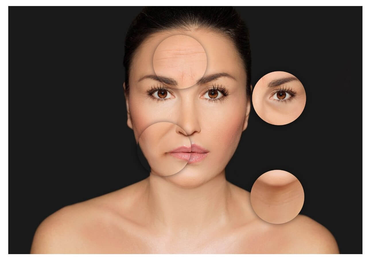 What Causes Collagen Breakdown Besides Age?